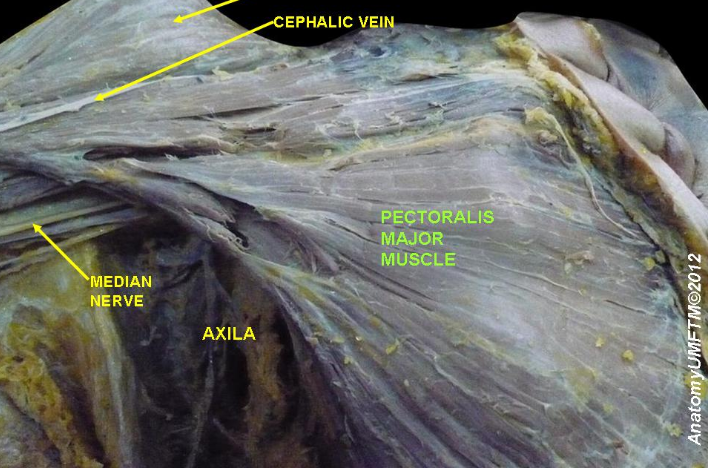 Pectoralis Minor Cadaver