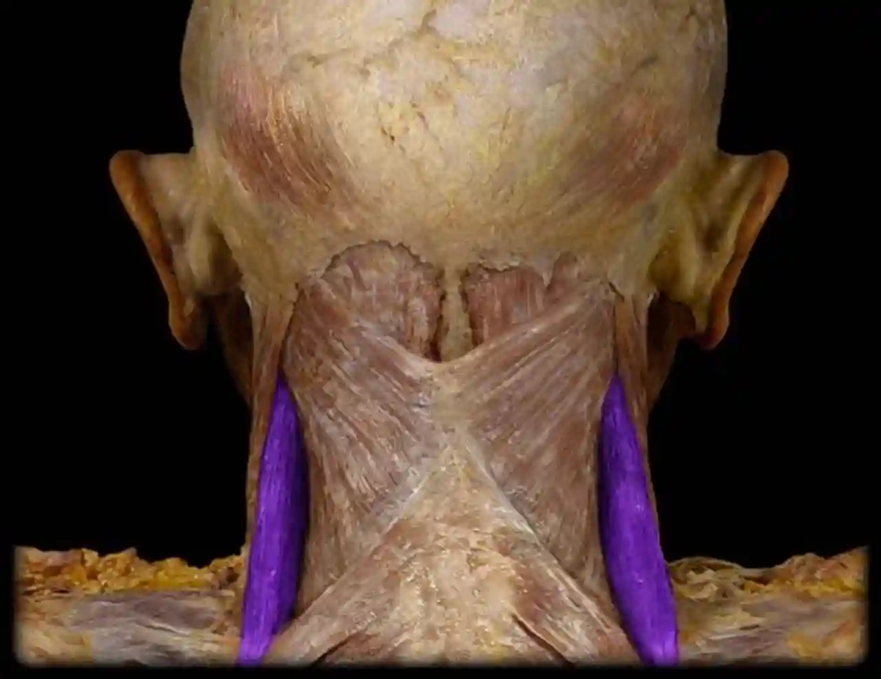 Levator Scapulae - Brookbush Institute