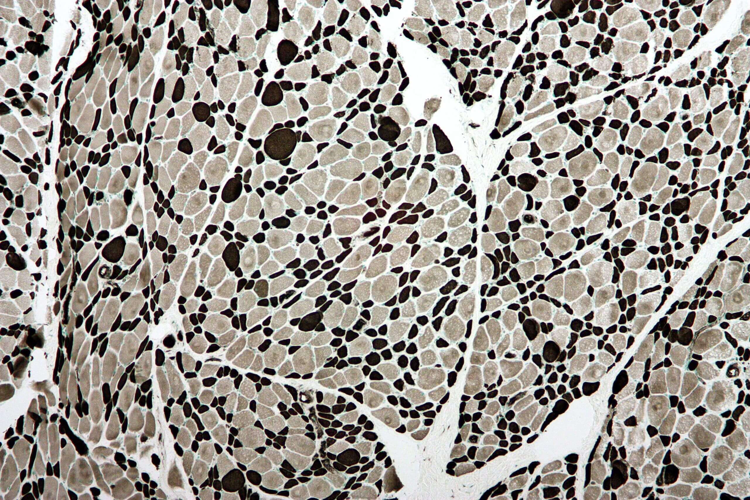 Muscle Fibers In Real Life
