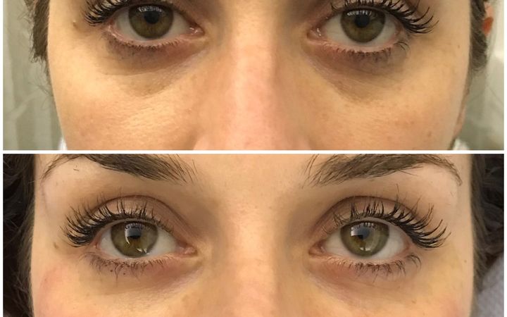 Dr Aisha Siddiqi - Dr Aisha Aesthetics | Glowday Dr Aisha Siddiqi - Dr Aisha Aesthetics | Glowday