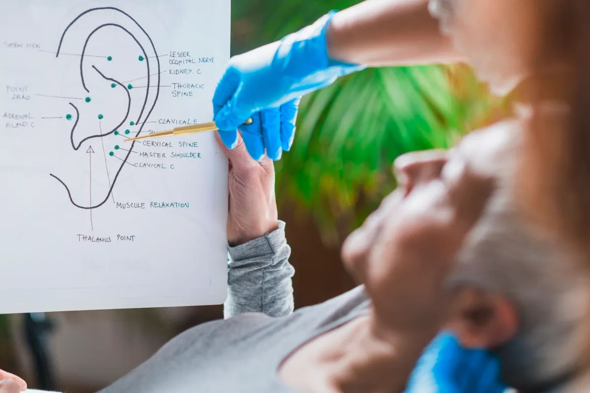 Acupuncture Basics