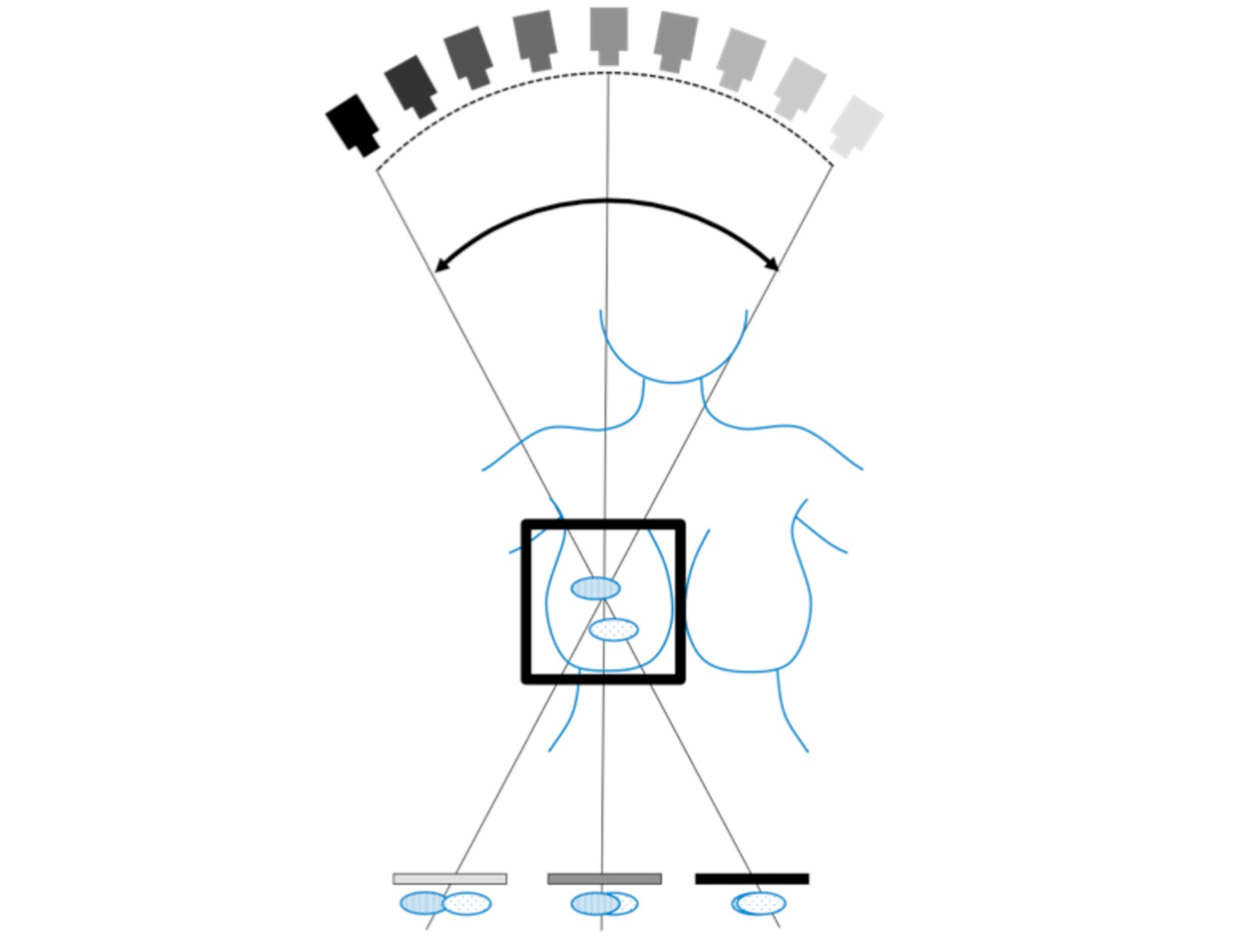 What Are the Benefits of 3D Mammography (Digital Breast Tomosynthesis)