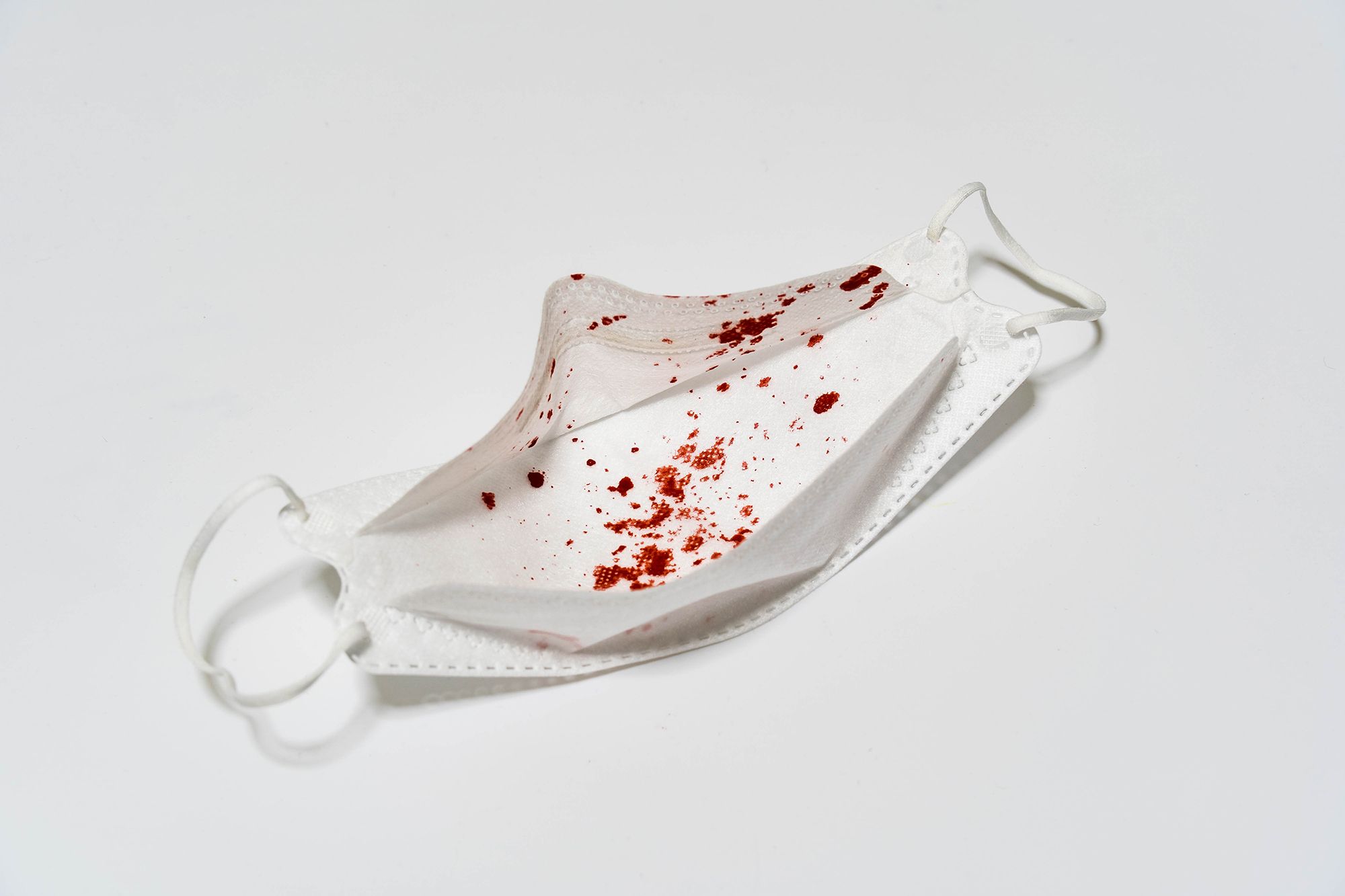 Unveiling the Reality: Lung Cancer's Impact on Public Health in the ...