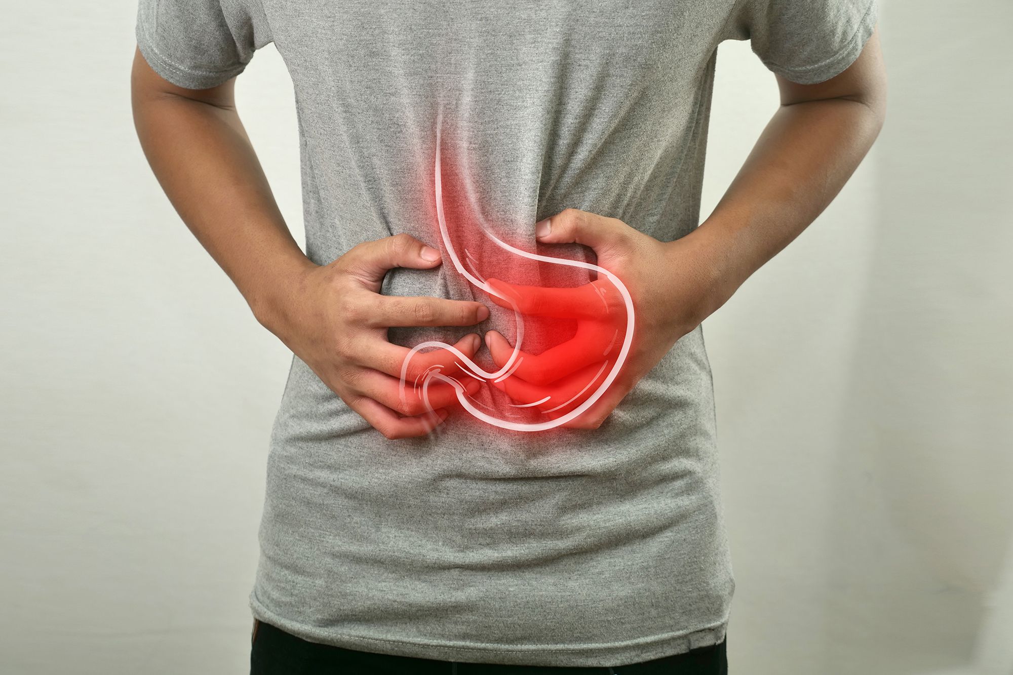 Stomach Cancer in Young Adults