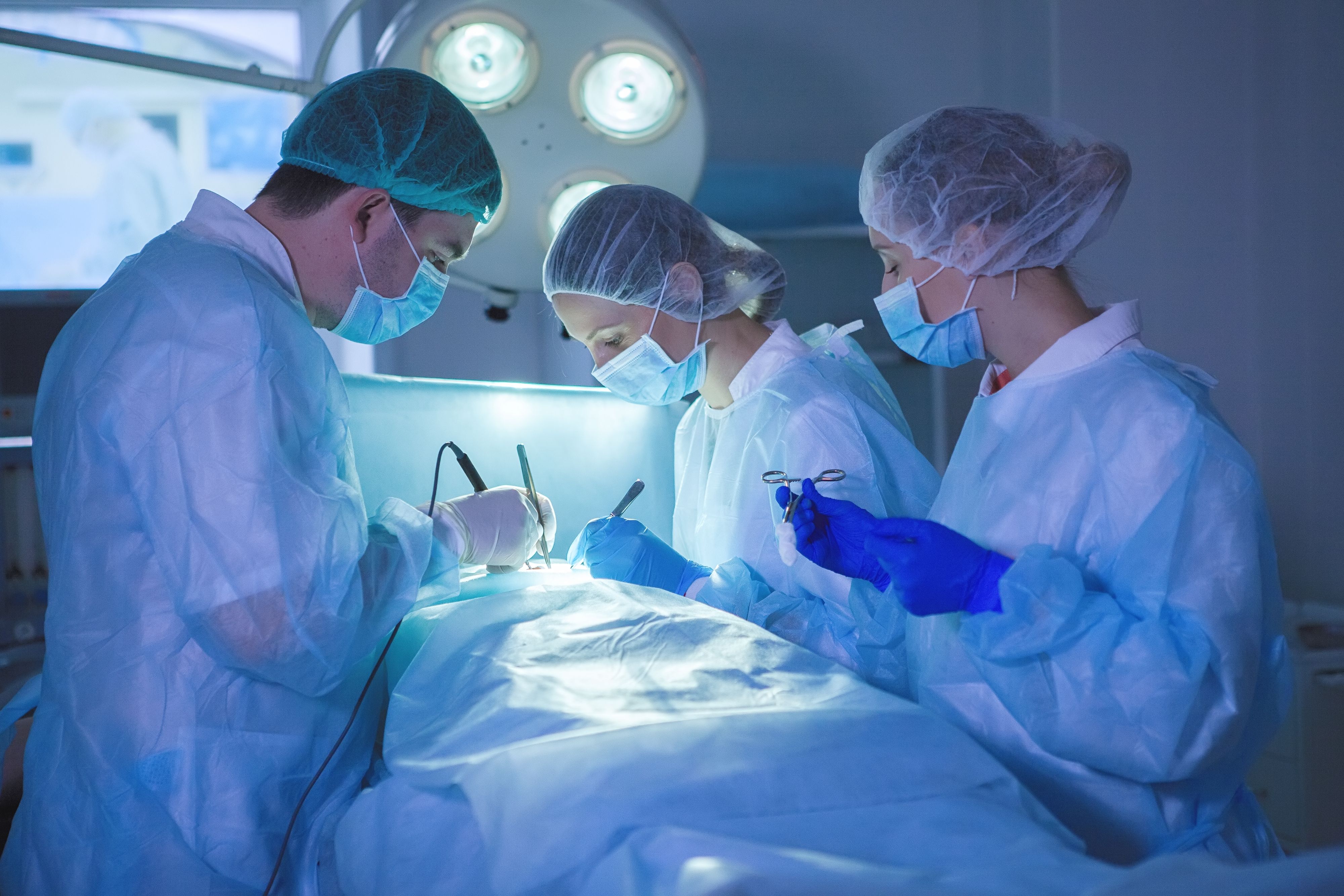 Surgery for Colon Cancer