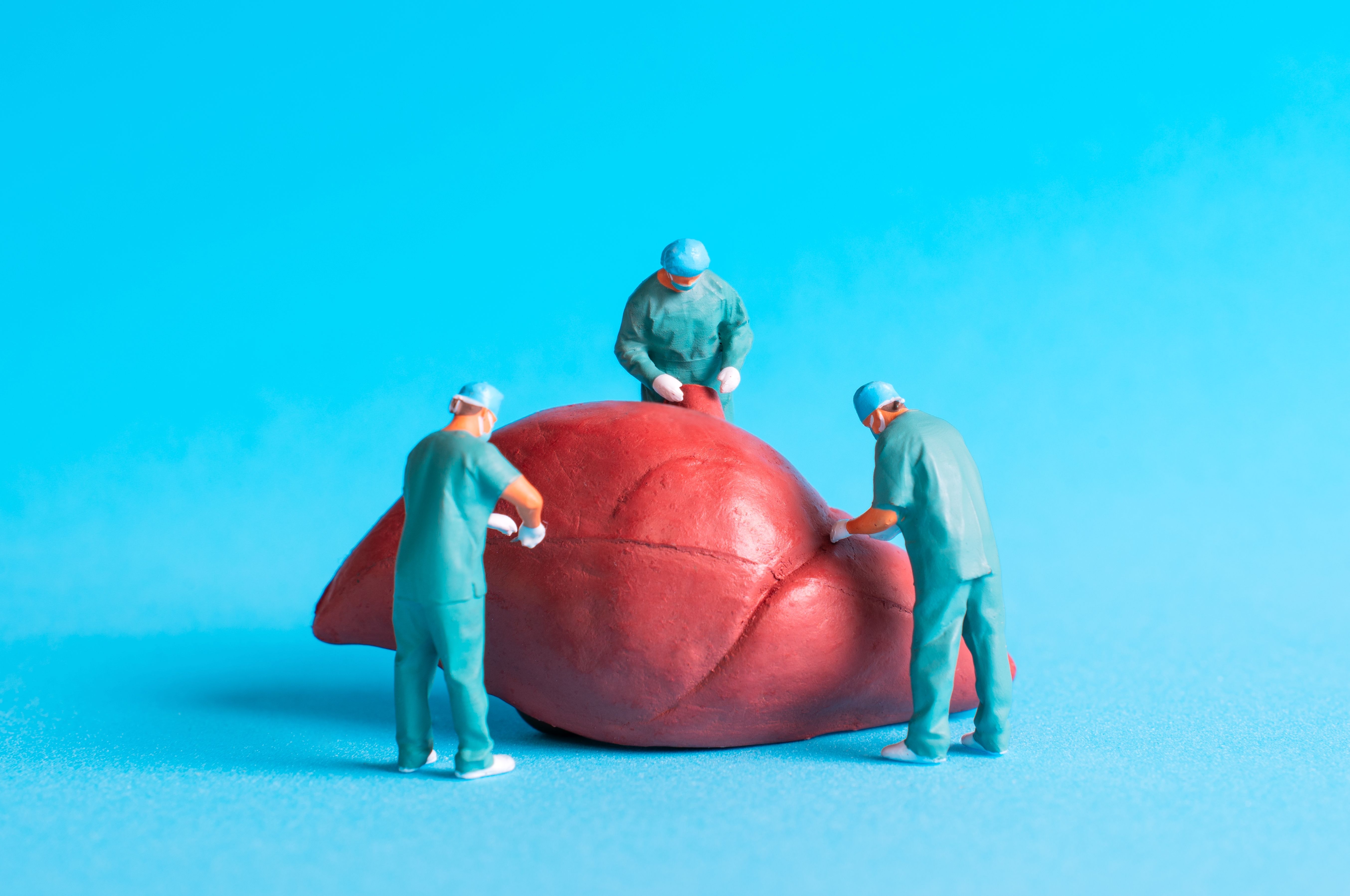 Partial Hepatectomy for Liver Cancer