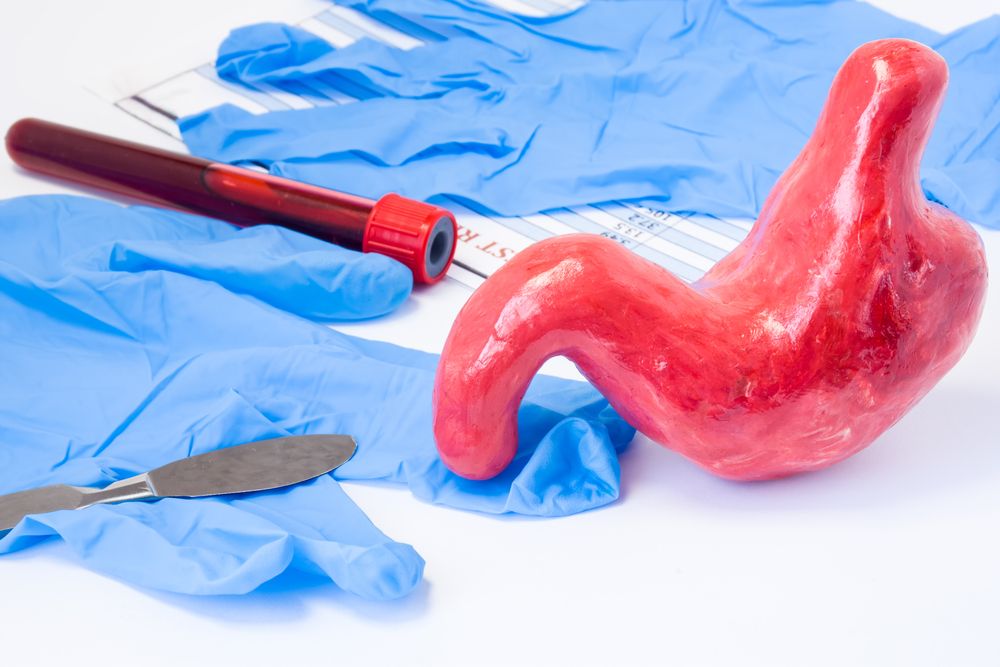 Gastric NETs Surgery