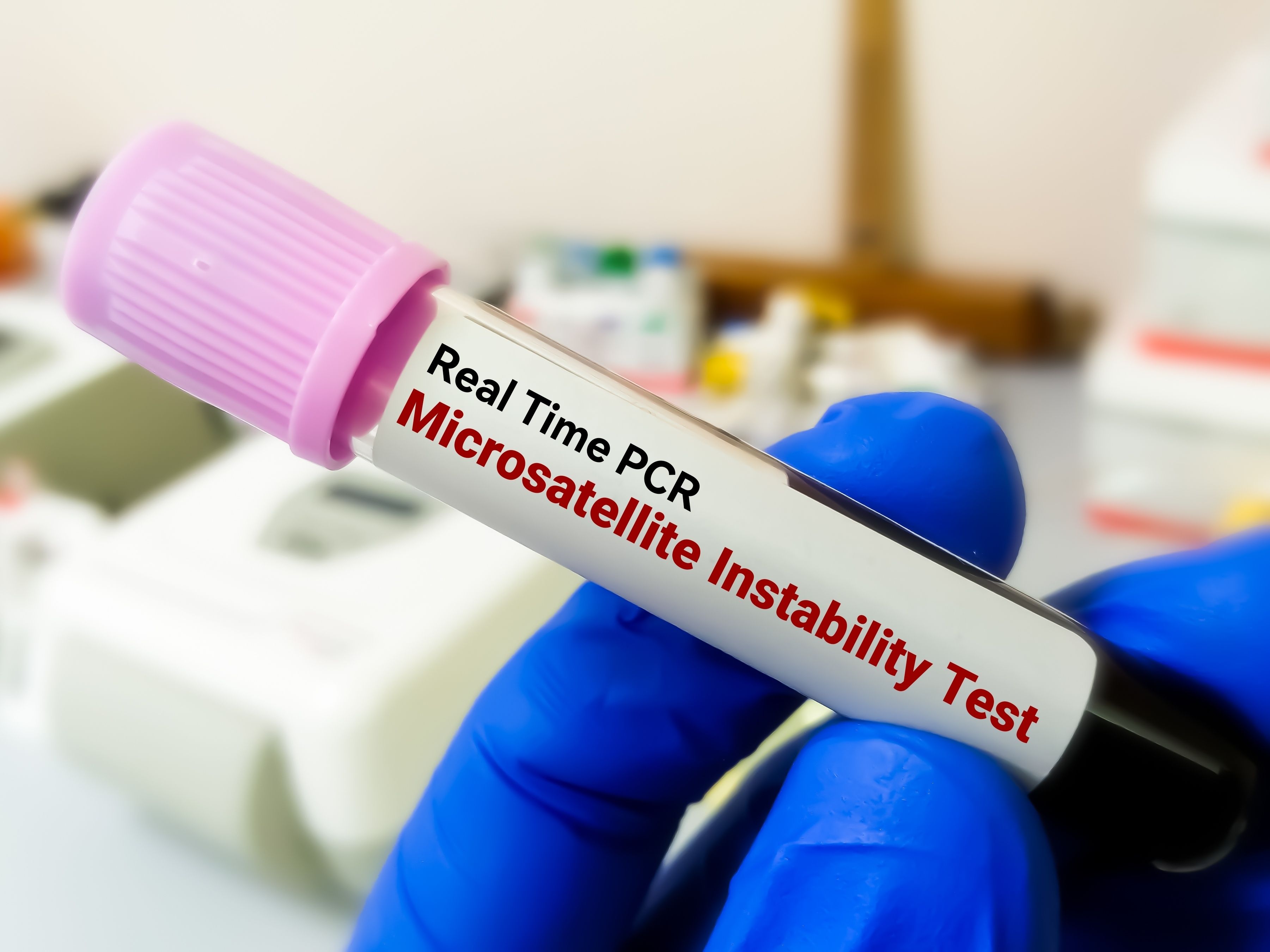 Microsatellite Instability & Stomach Cancer