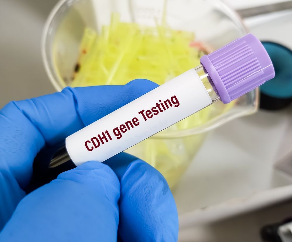 Should You Get Genetic Testing for HDGC?