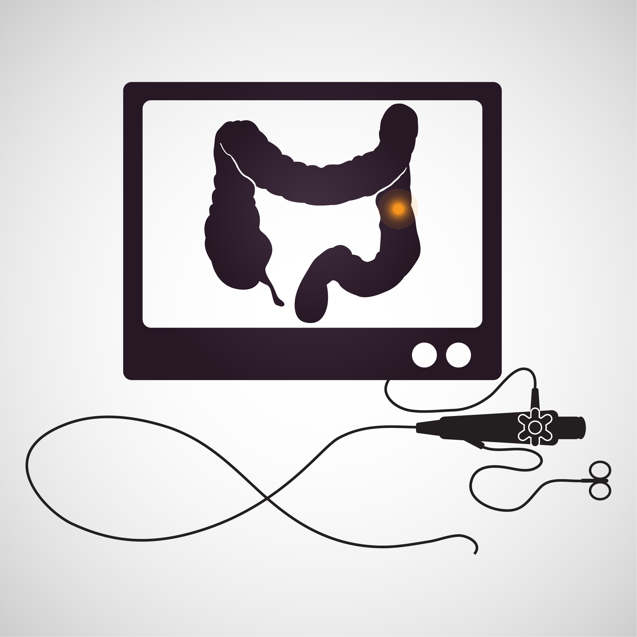 Understanding Your Colonoscopy Report