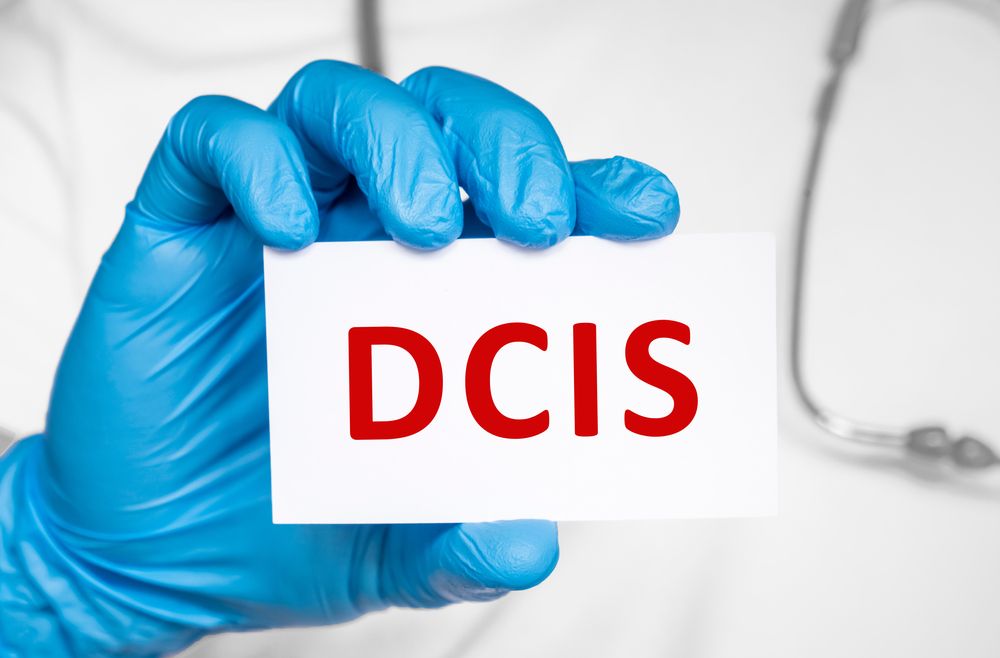 A Comprehensive Overview of Ductal Carcinoma In Situ (DCIS)