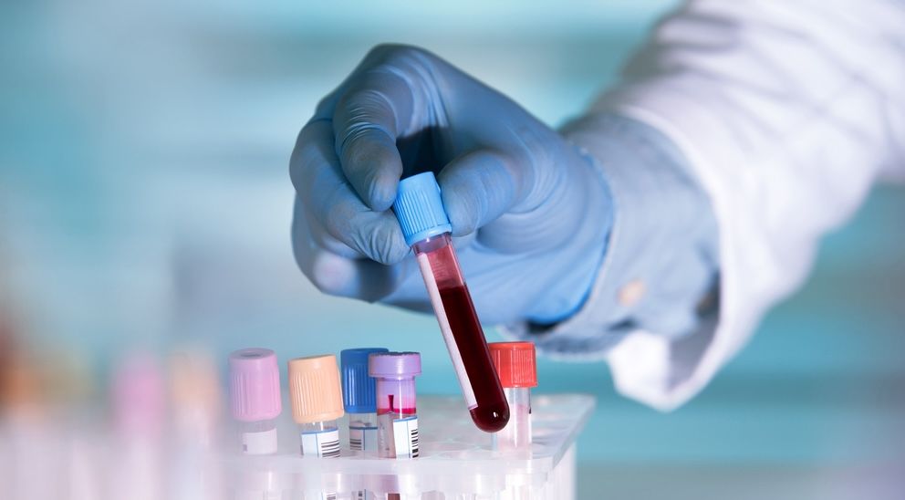 GASTROClear & Stomach Cancer Detection