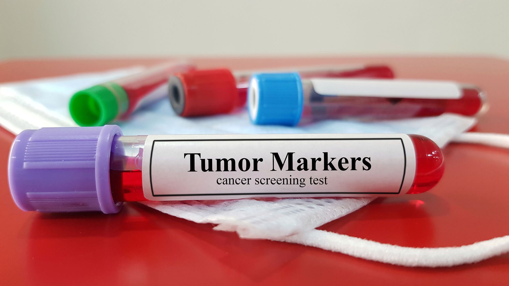 Biomarkers in Stomach Cancer