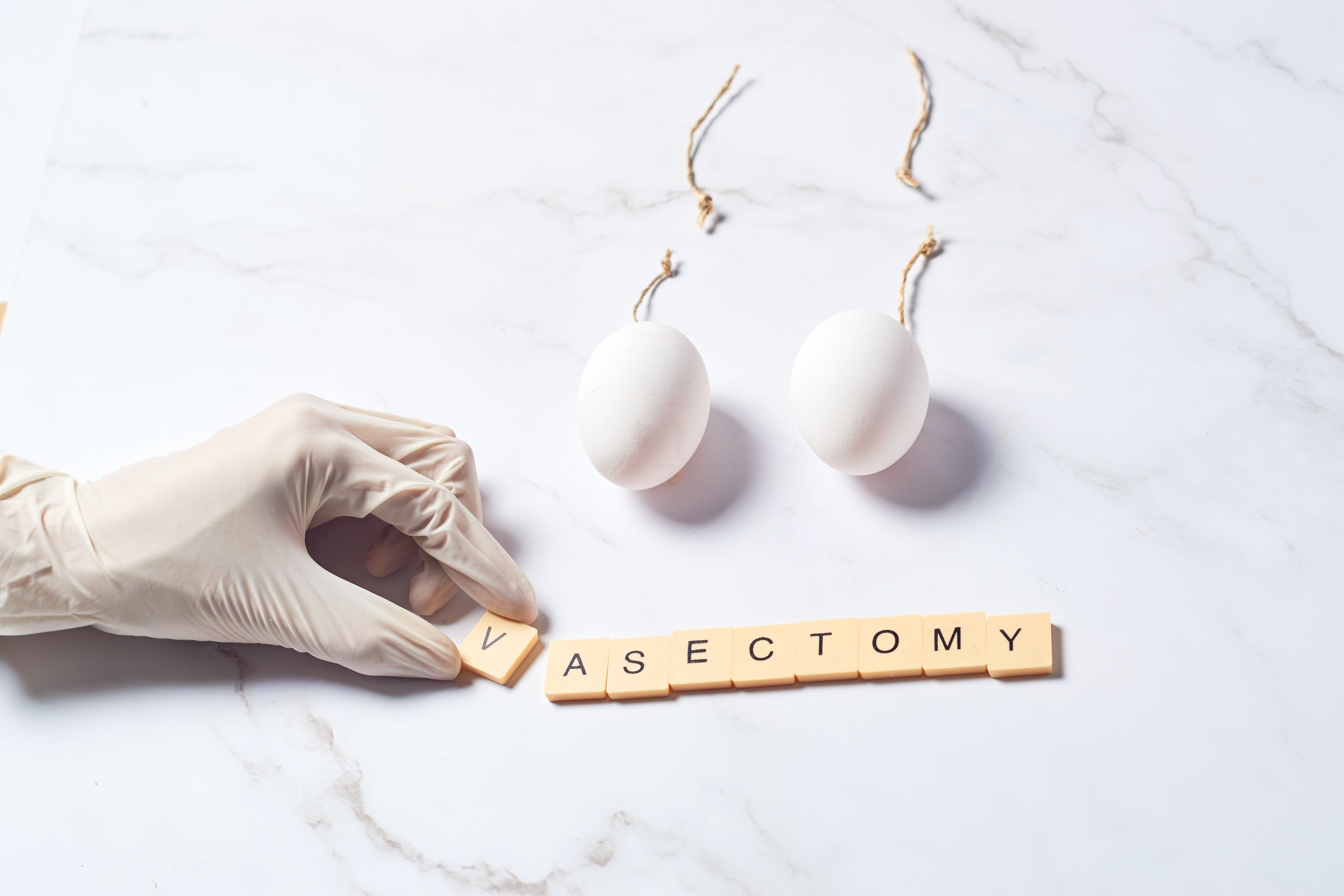 Vasectomy and Prostate Cancer