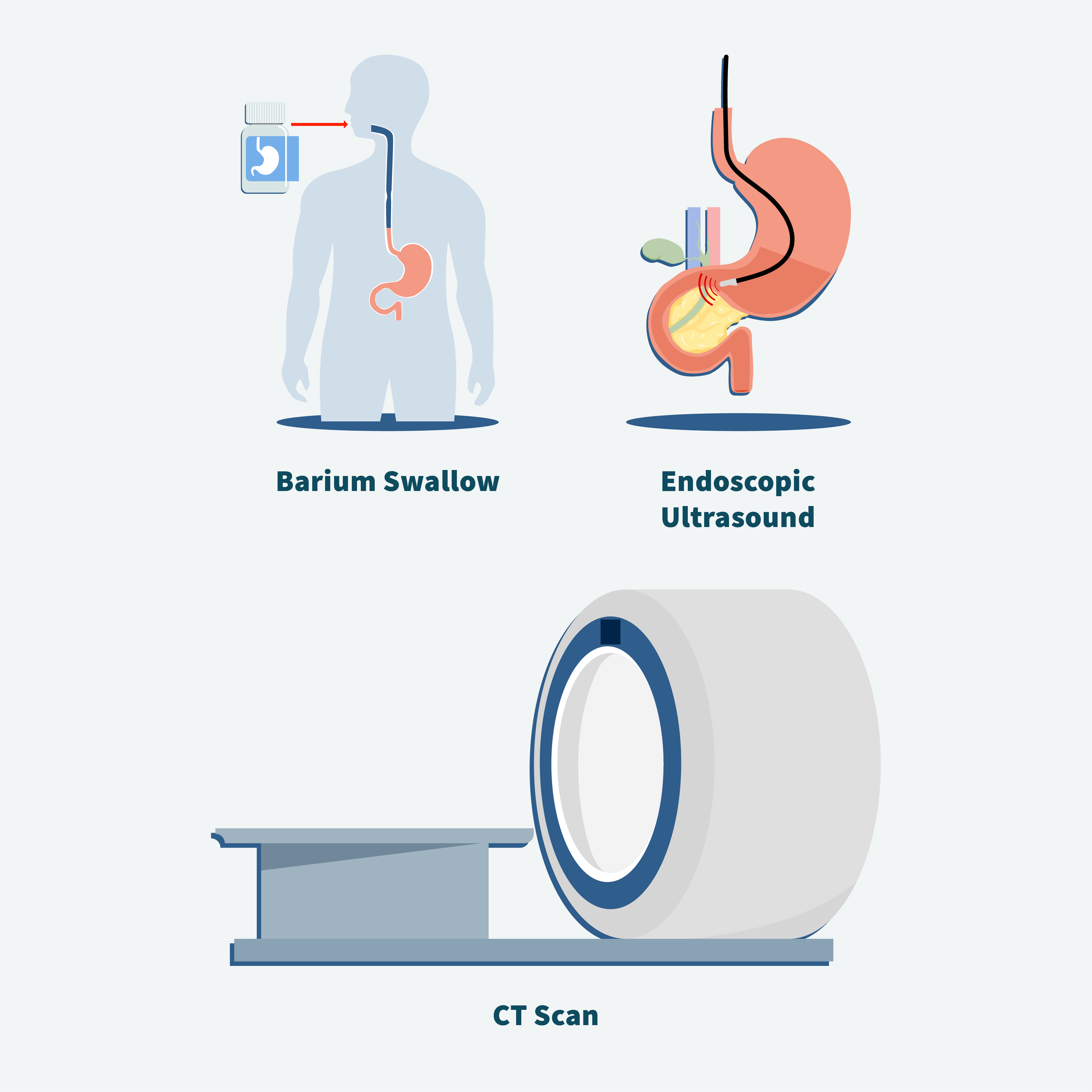 Tests & Scans for Staging Stomach Cancers