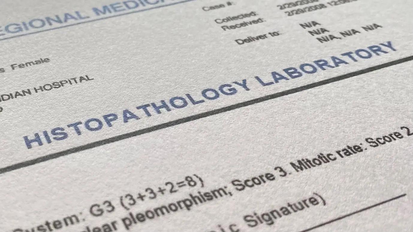 Understanding Your Histopathology Report: Classification of Breast Cancer