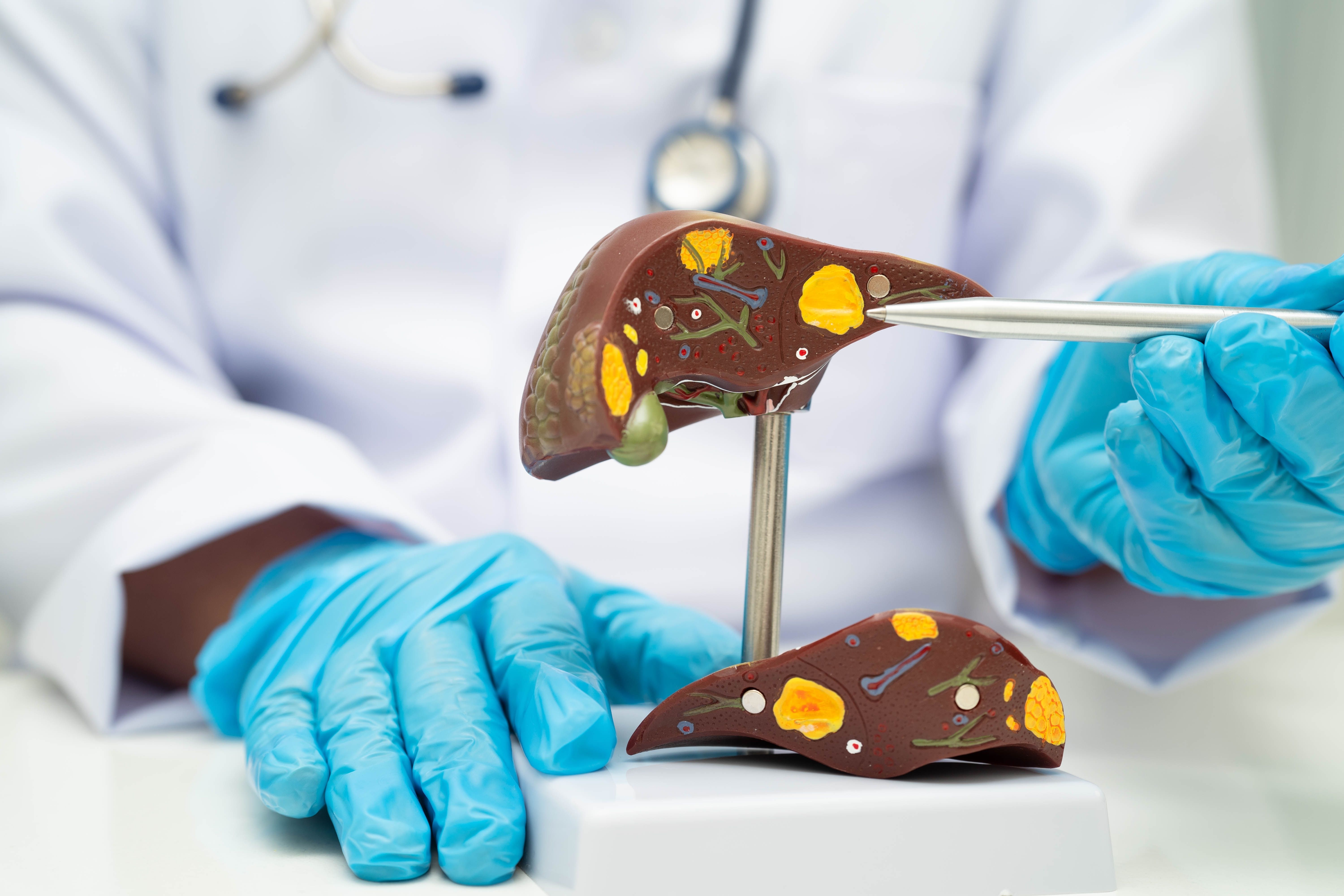Liver Cancer Types