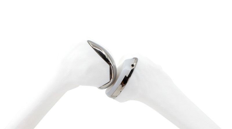 Robotic Surgical Technology | Orthopaedics | INOV8 Surgical