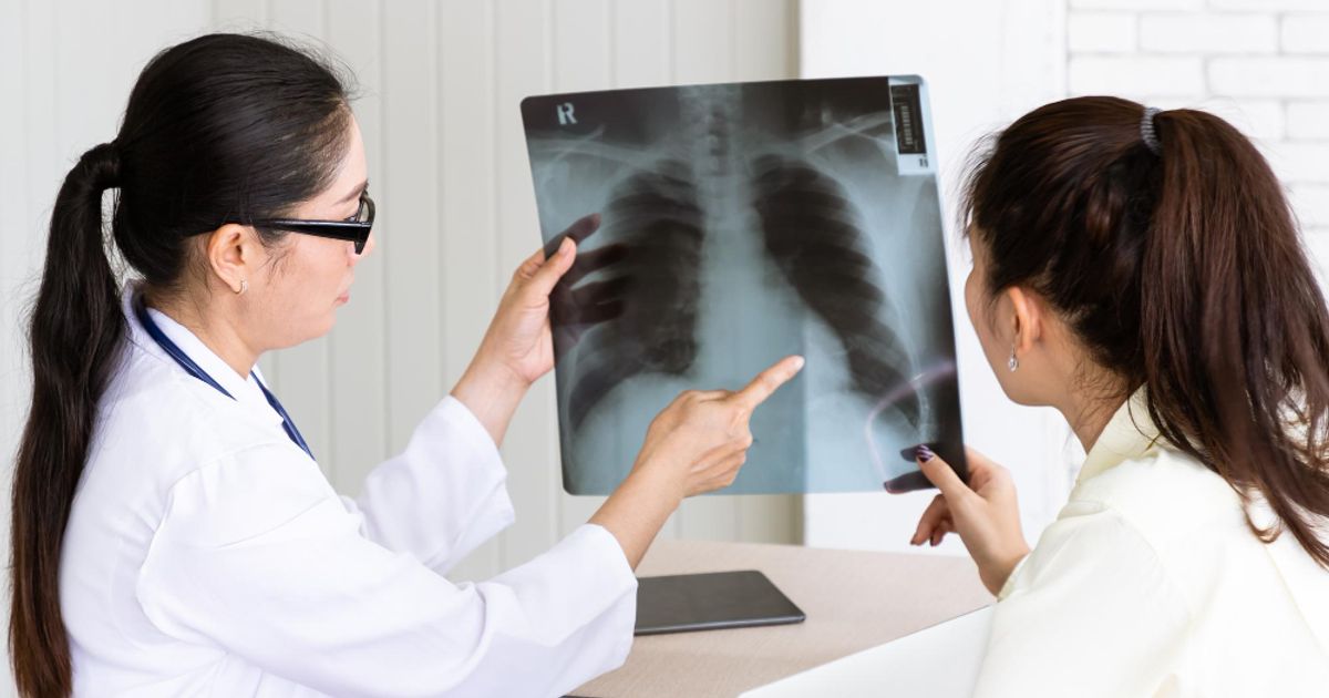 Low Radiation CT Lung Screening | Regency Medical Care Centre