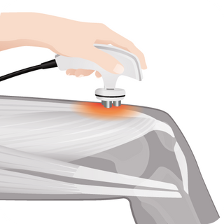 Winback TECAR therapy I Eliminate pain, restore movement and optimise ...