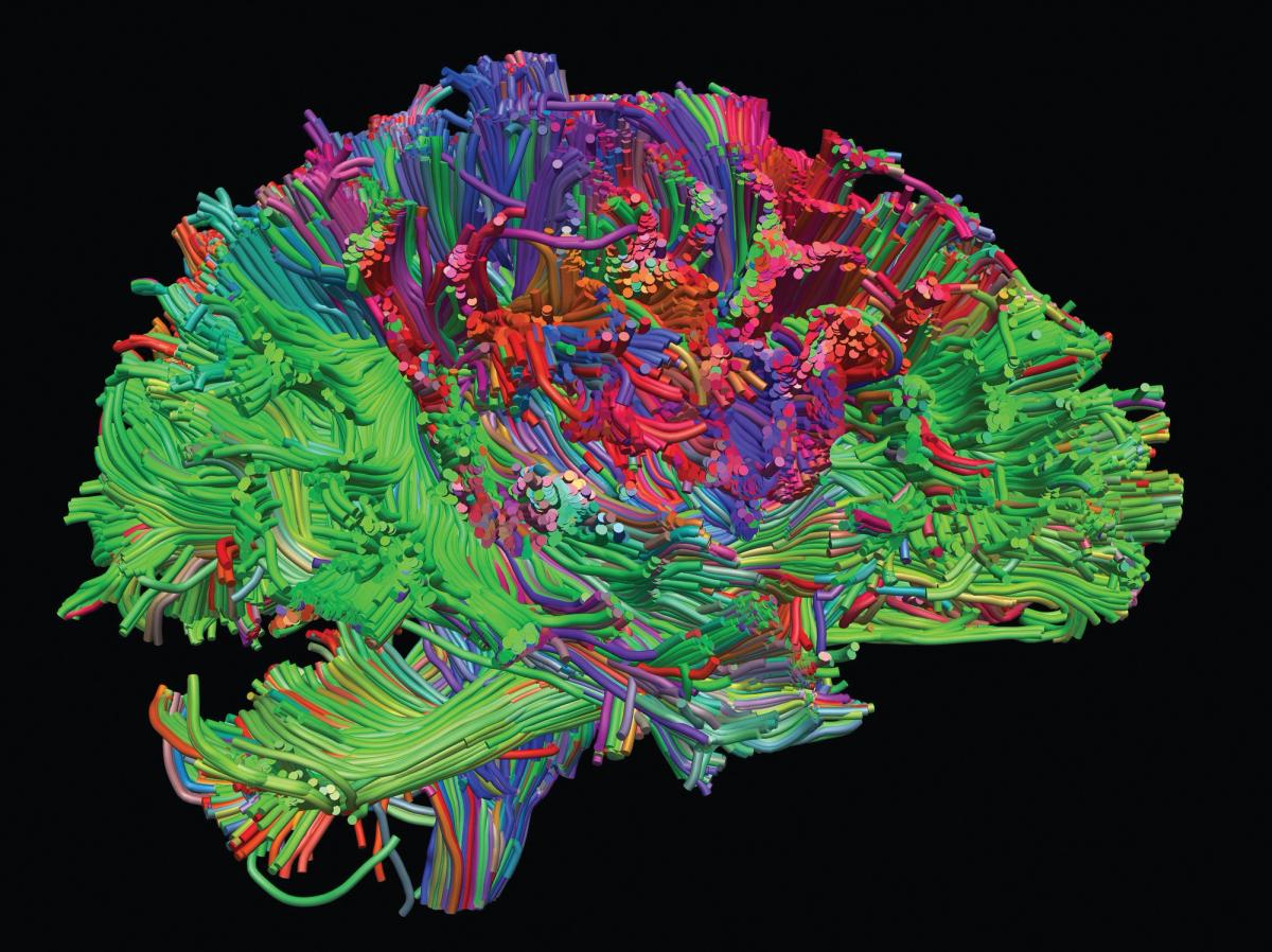 Kavli Prize Laureate Michael Merzenich | The Kavli Prize