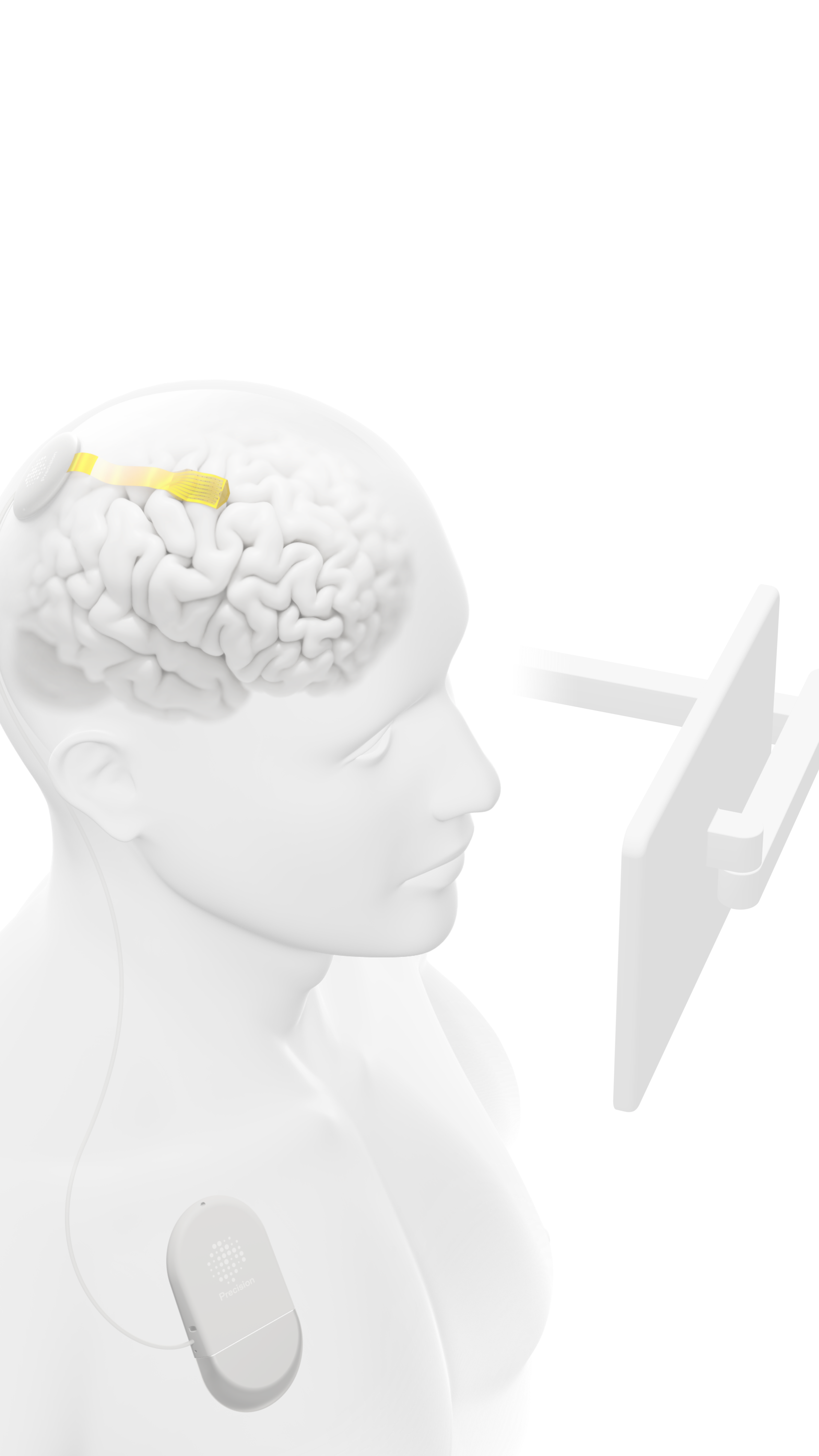 Precision - Precision