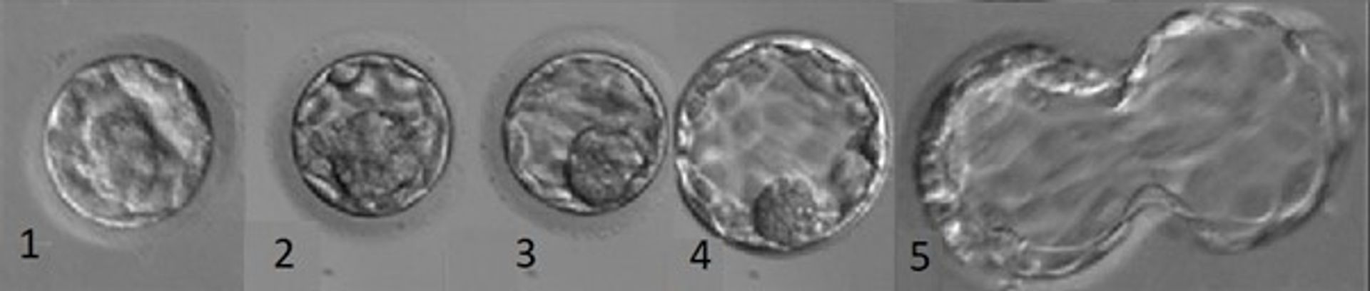 How embryos are graded | Adora Fertility