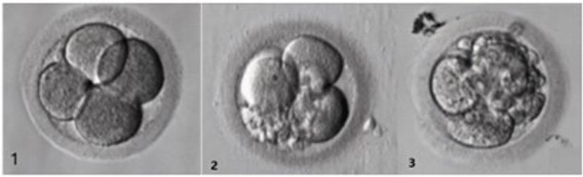 How embryos are graded | Adora Fertility