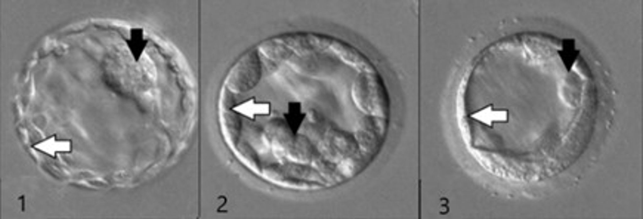 How embryos are graded | Adora Fertility