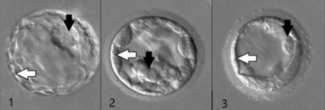How embryos are graded | Adora Fertility