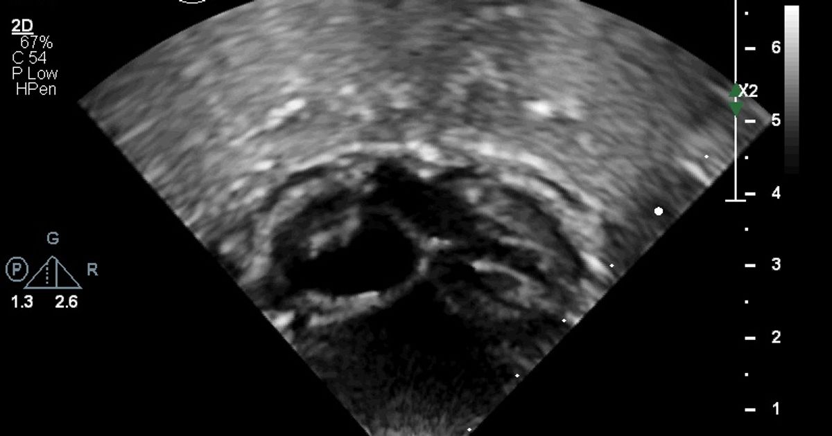 Infant/Fetal Dataset | ISys Research Group Infant/Fetal Dataset | ISys Research Group