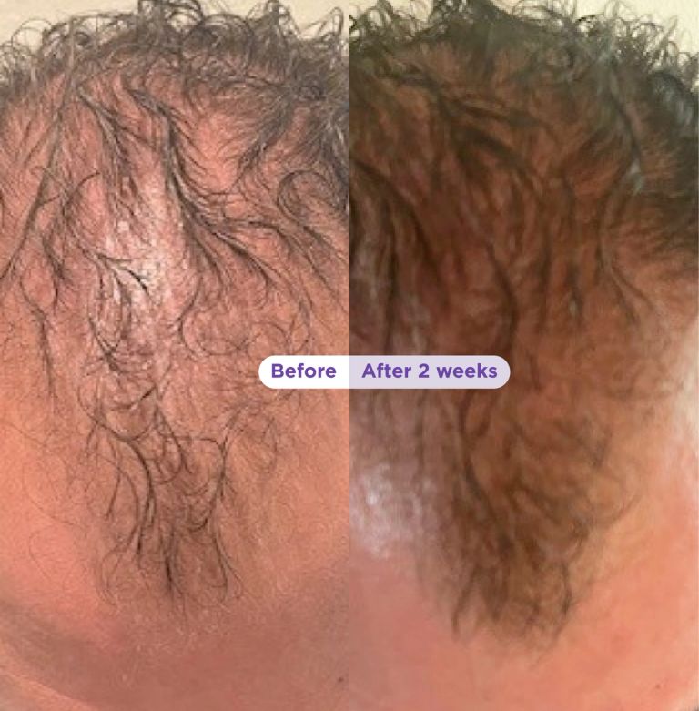 Scalp Revitalizing Solution Miracle in Shower Treatment - Dr. Groot ...