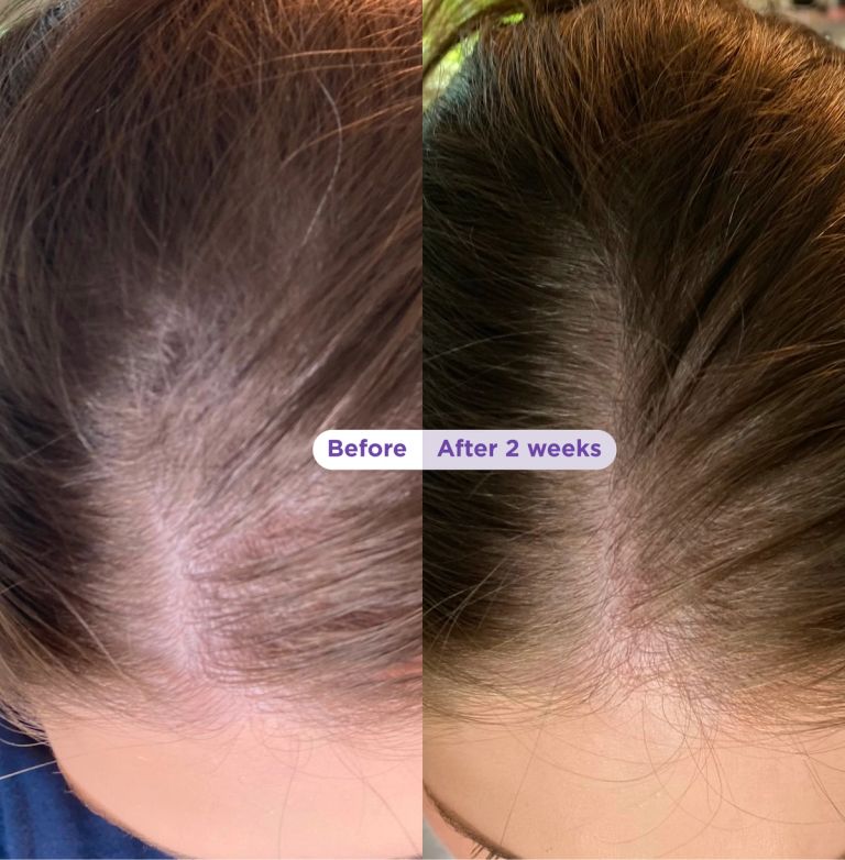 Scalp Revitalizing Solution Miracle in Shower Treatment - Dr. Groot ...