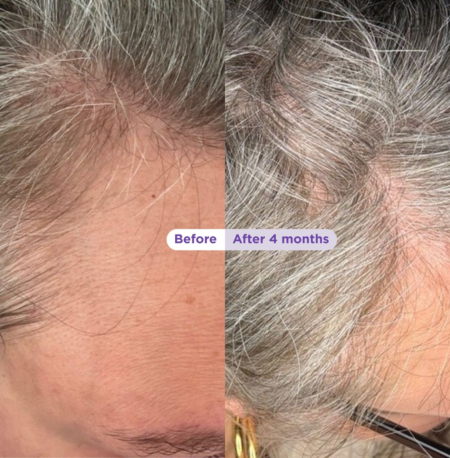 Dr. Groot Korean Hair Care - Official Website | LG beauty