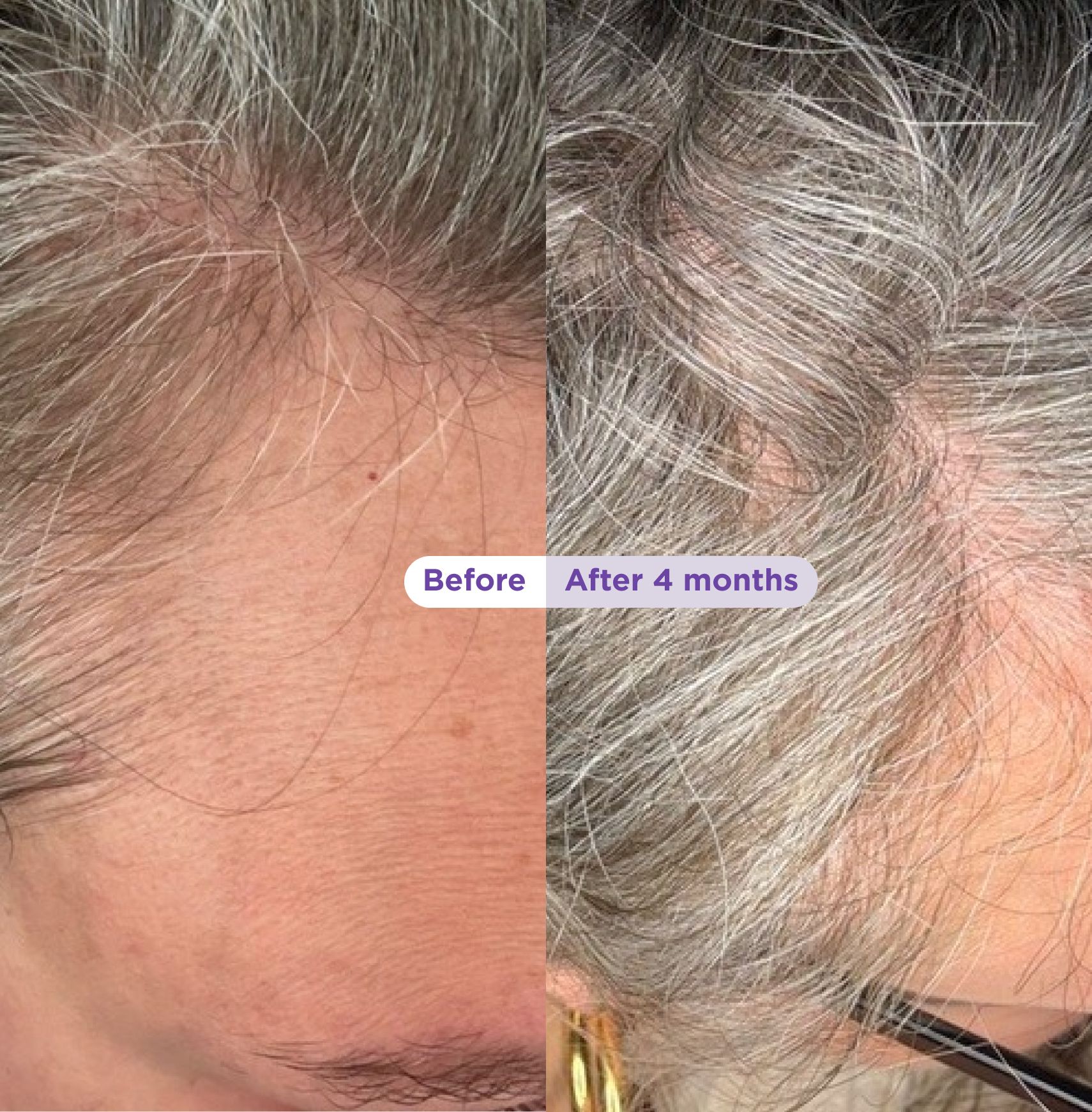 Dr. Groot Korean Hair Care - Official Website | LG beauty