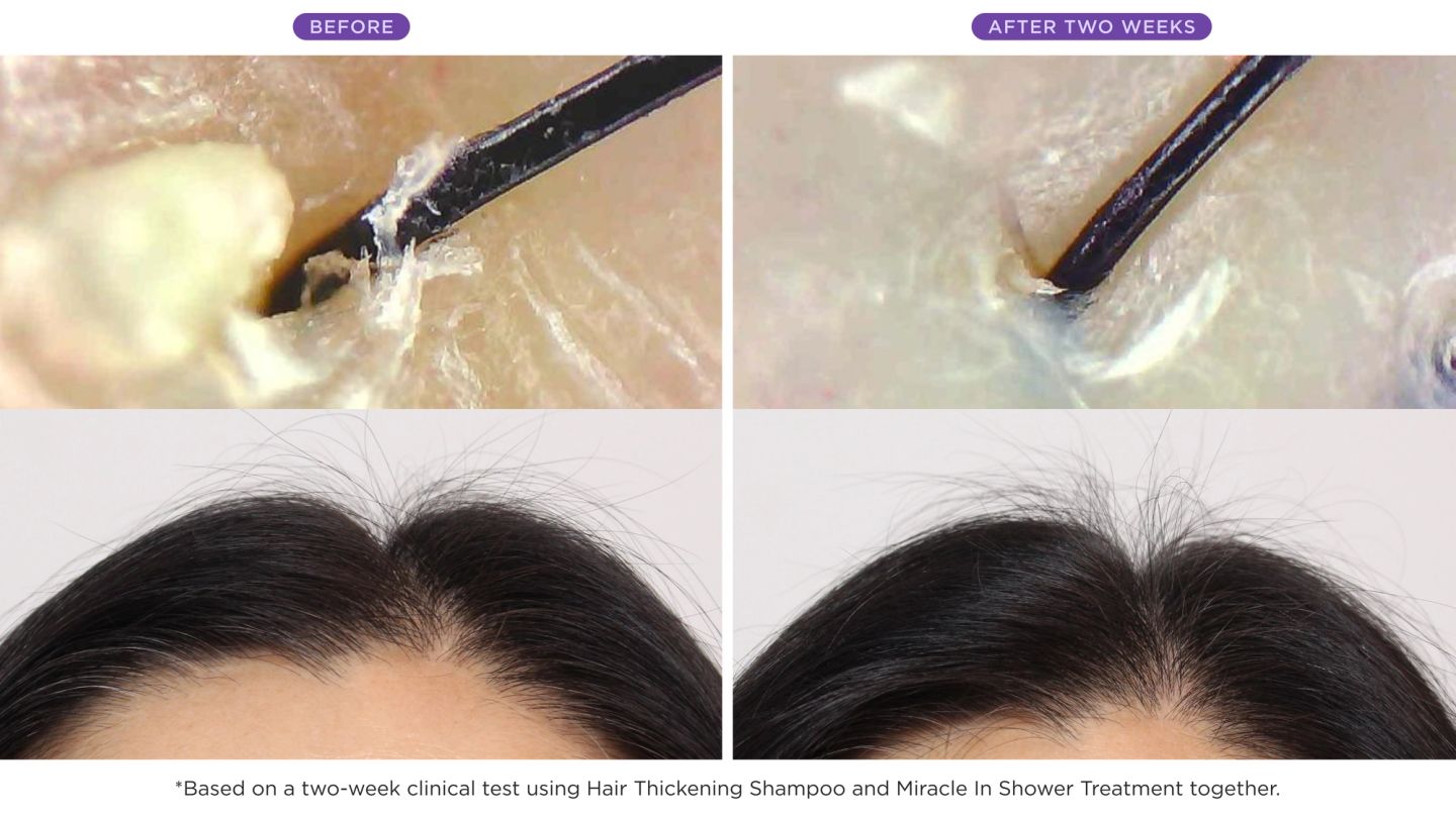 Great Hair Starts at the Scalp | LG beauty