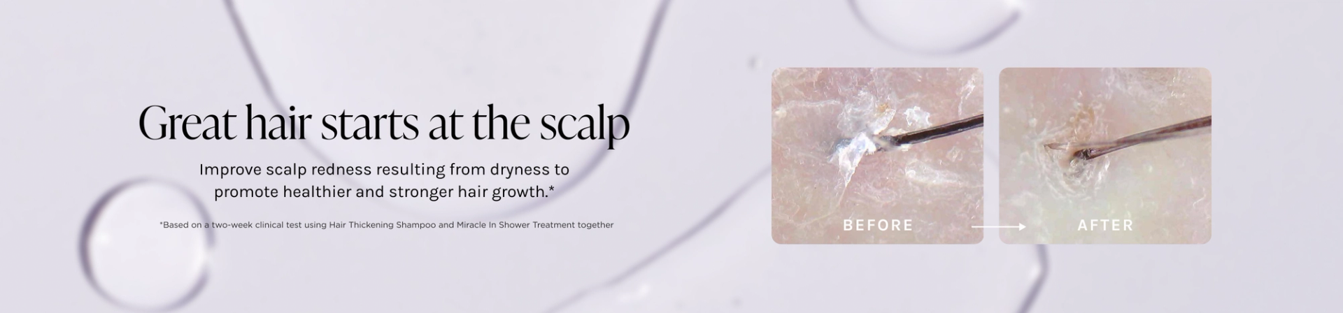 Scalp Revitalizing Solution Miracle in Shower Treatment - Dr. Groot ...
