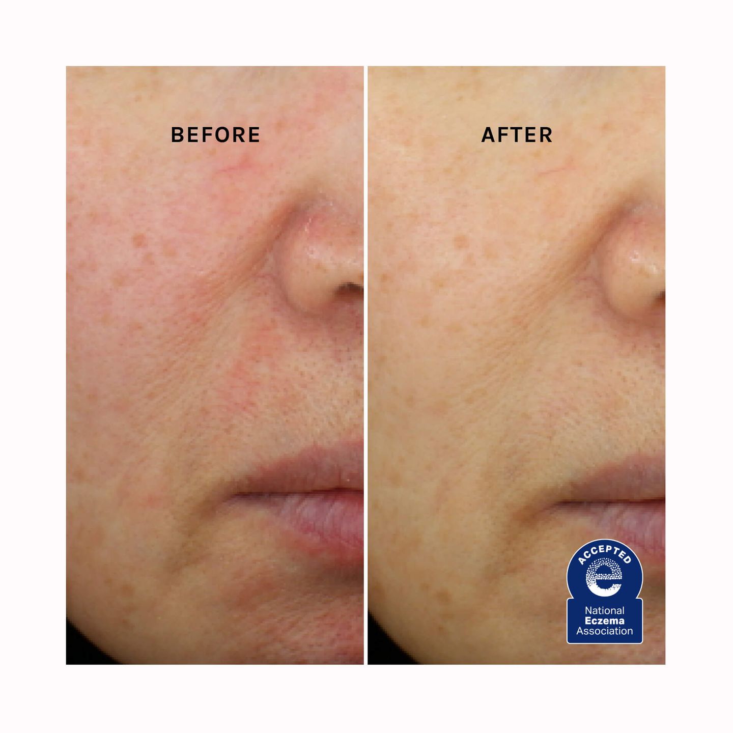 Calming Relief Redness Relieving Cream