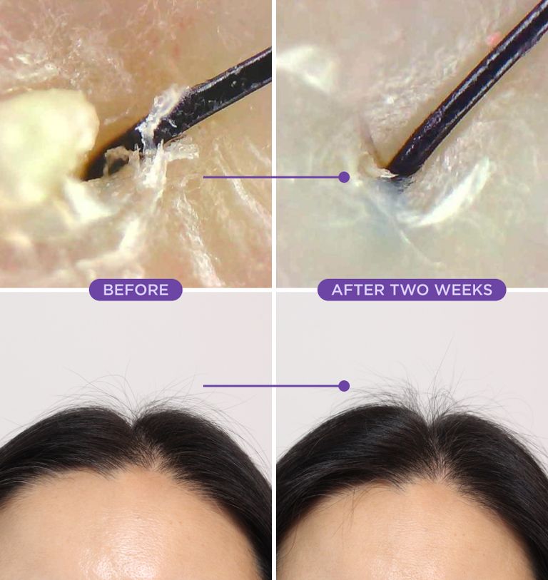 Scalp Revitalizing Solution Complete Set to Reduce Hair Loss