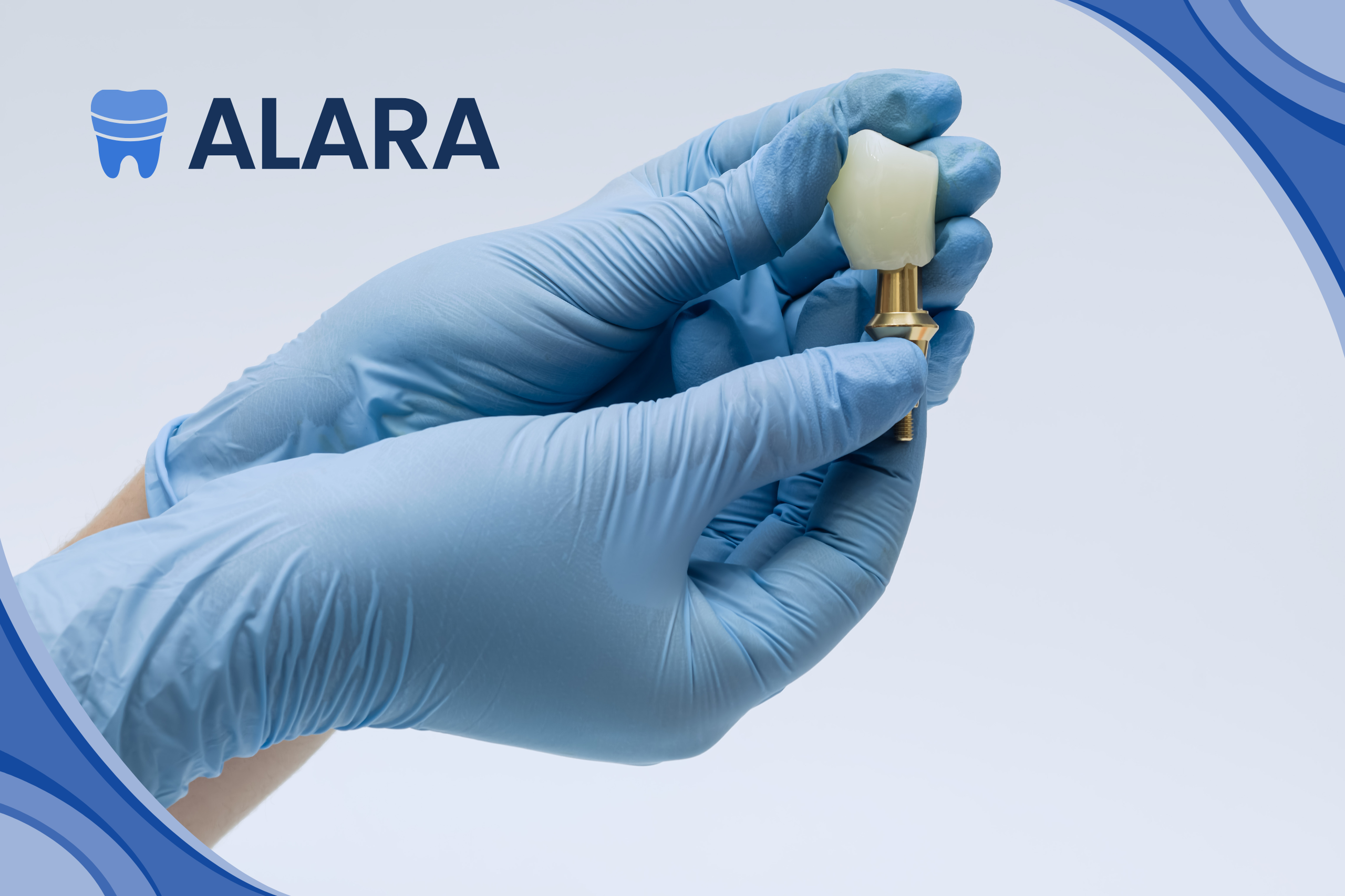 Dental Cement for Crowns: Clinical Guide 2026 | Alara