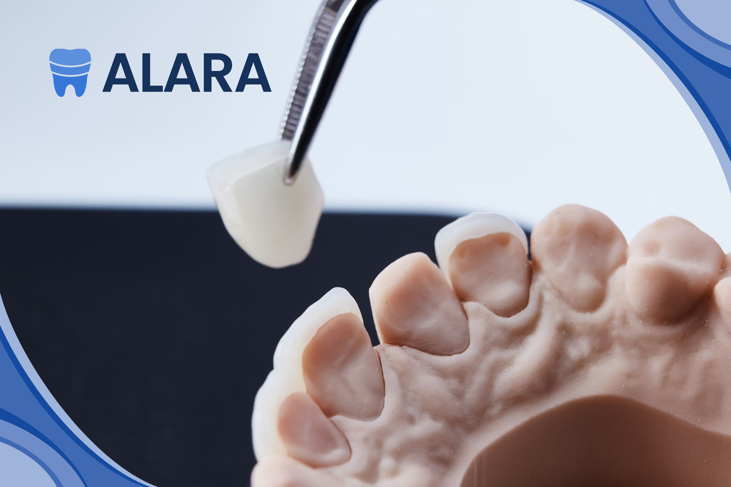 Lithium Disilicate: Material Science and Bonding Protocols | Alara Blog