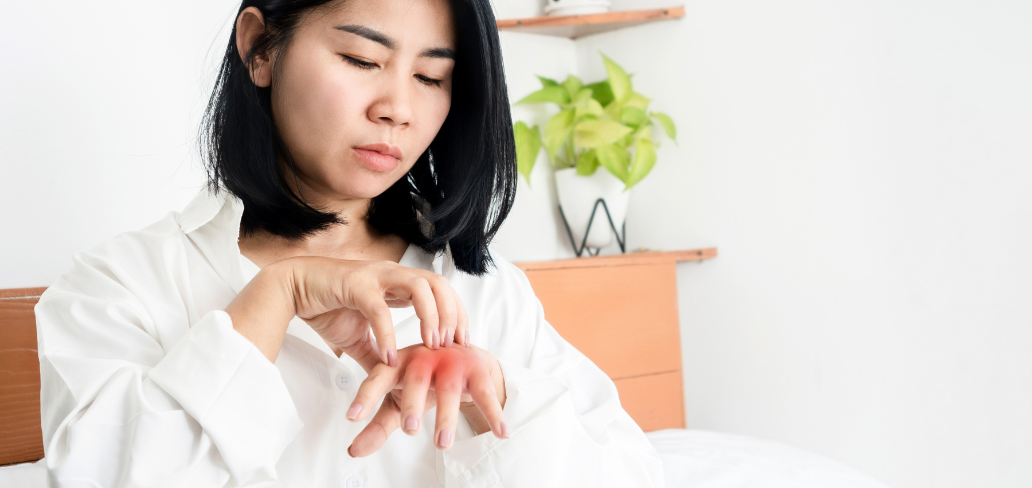 Red, itchy skin flare-ups: how to tell if you have eczema and when you ...
