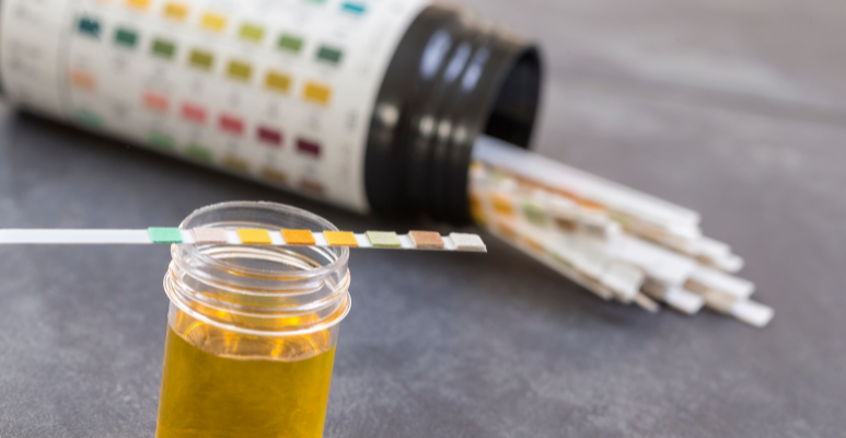 What does each part of the dipstick test mean? | HMI Medical