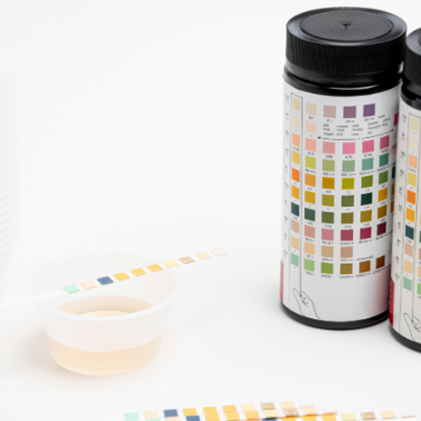 What does your urine dipstick results mean? | HMI Medical
