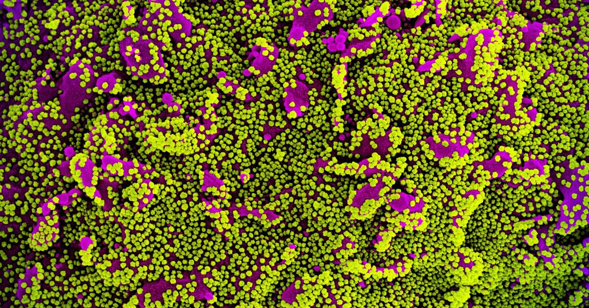 Venner eller fiender | Klassekampen