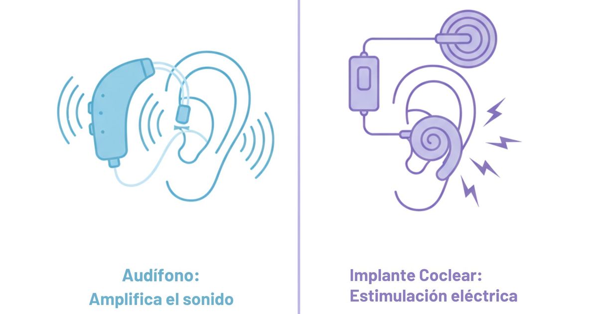 Audífono vs implante coclear: ¿cuál necesitas tú? | RehabAuditiva