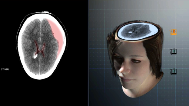 Fully-Interactive TBI Exhibit | 3D Forensic
