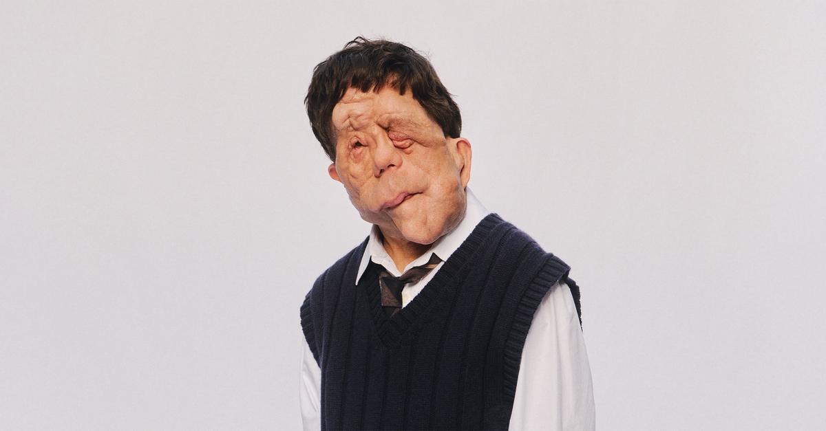 Adam Pearson interview: The A Different Man actor on changing ...