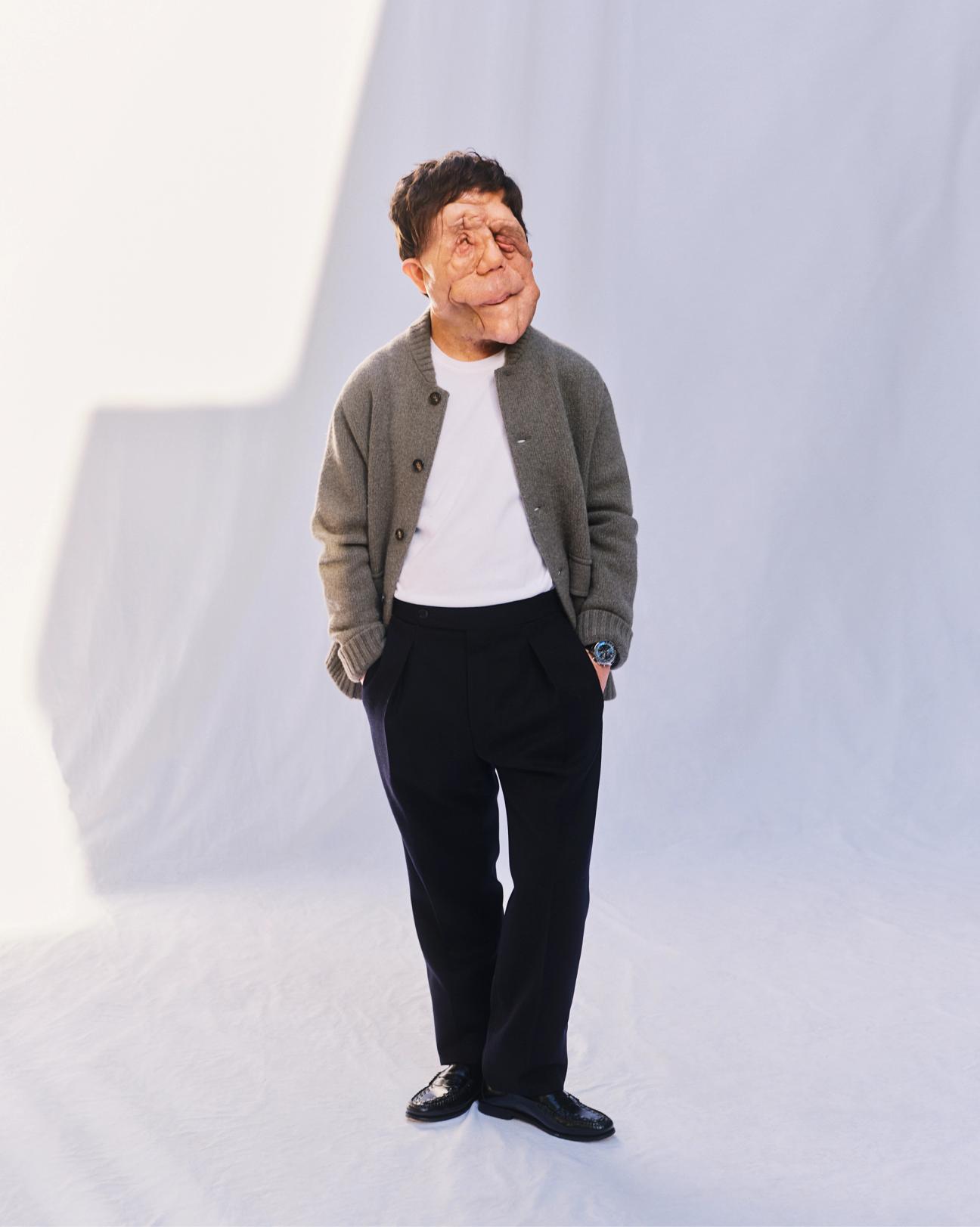 Adam Pearson interview: The A Different Man actor on changing ...