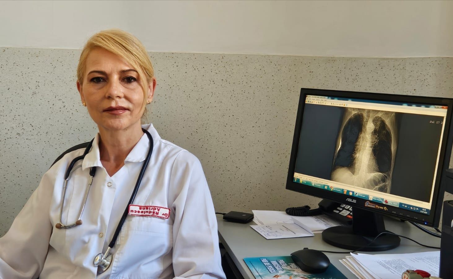 Peste 70 de persoane cu cancer pulmonar tratate la Spitalul ...